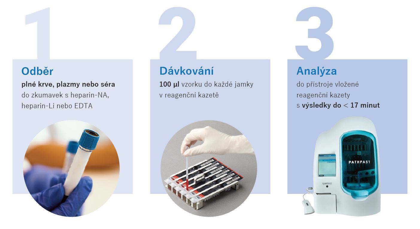 Přednosti PATHFASTu - Presepsin