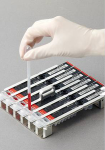 Presepsin | MEDESA s.r.o. - Presepsin