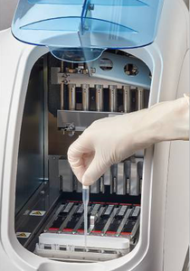 Presepsin | MEDESA s.r.o. - Presepsin